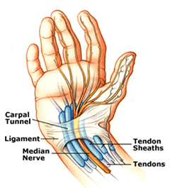 Understanding Overuse Injuries: Causes and Preventions for ...